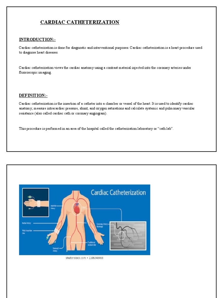 Cardiac Catheterization Procedure Guide | PDF | Heart | Circulatory System