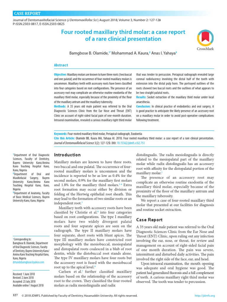 Four Rooted Maxillary Third Molar A Case Report of | PDF | Dental ...