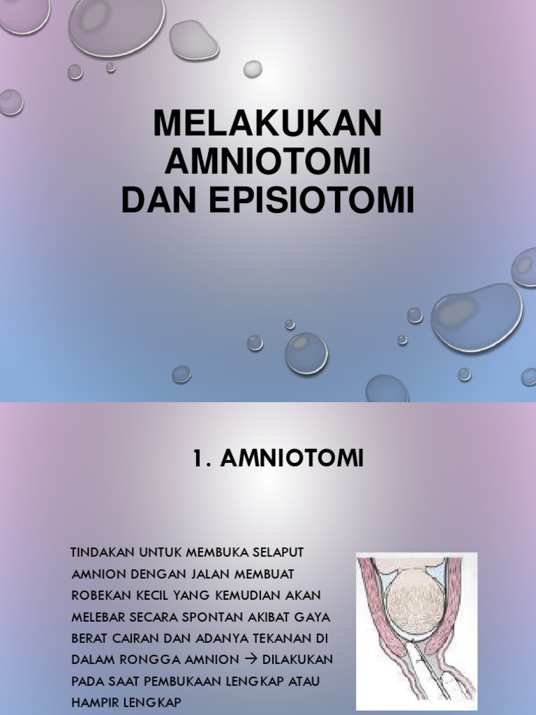 Amniotomi EPISIOTOMI | PDF