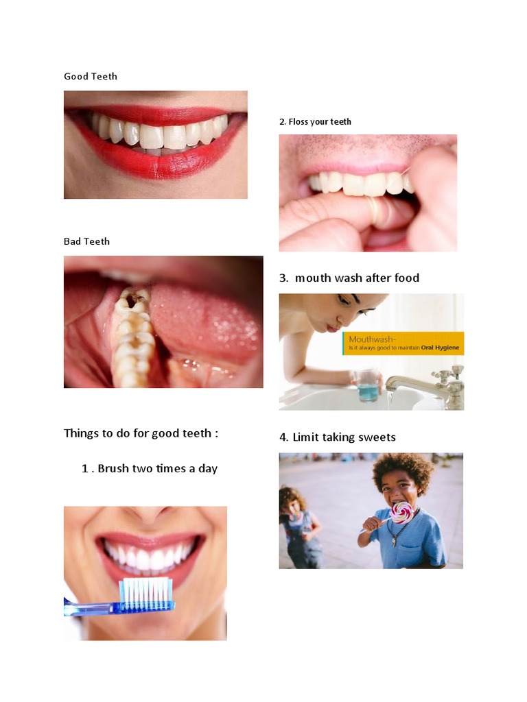 Teeth Good and Bad Teeth | PDF