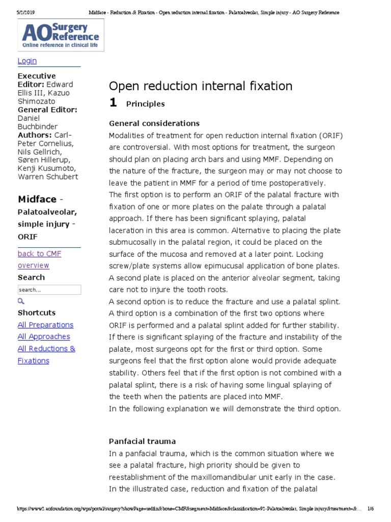 Palatal Midface - Reduction & Fixation - Open Reduction Internal ...