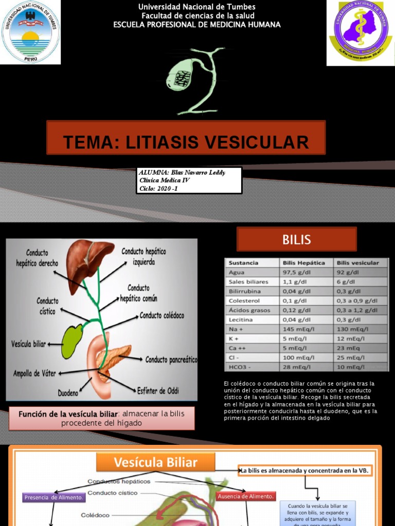 Litiasis Vesicular Expo | PDF | Vesícula biliar | Bilis