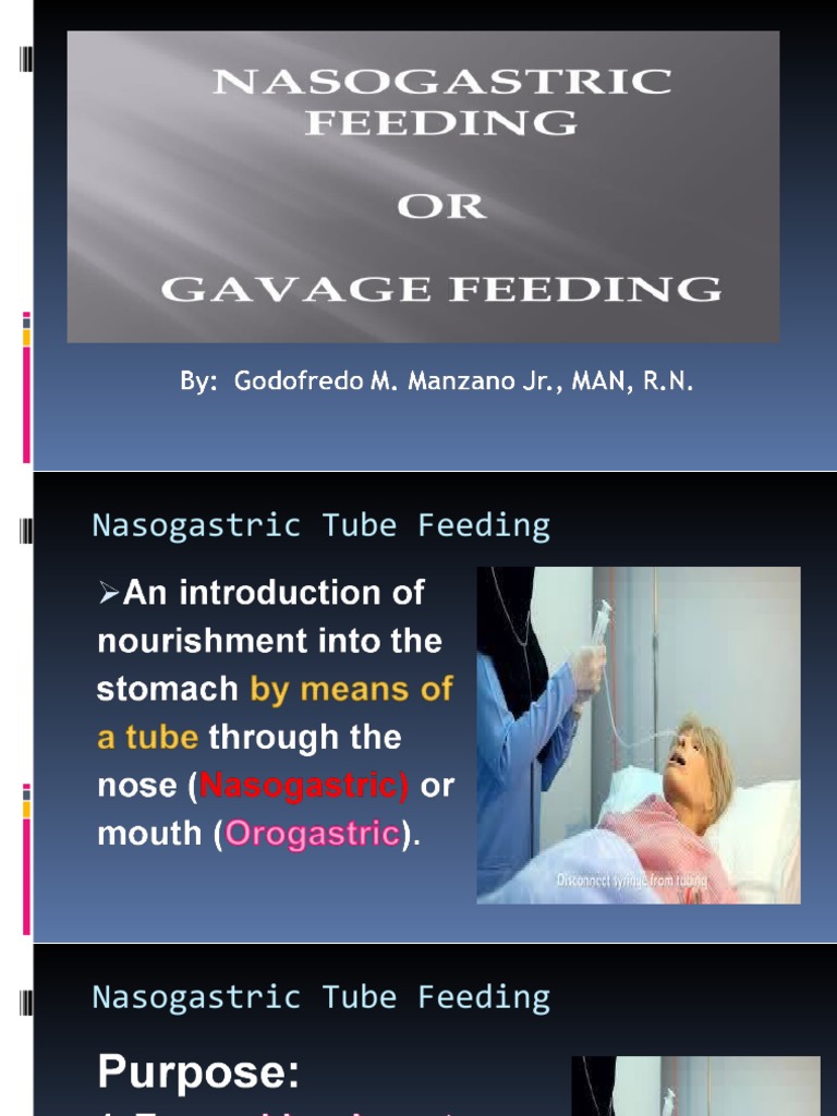 NGT Feeding | PDF | Gastroenterology | Diseases And Disorders
