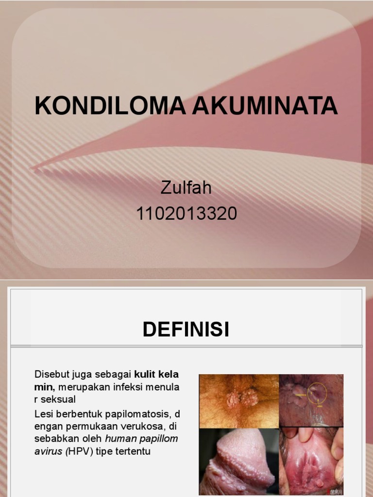 Kondiloma Akuminata | PDF
