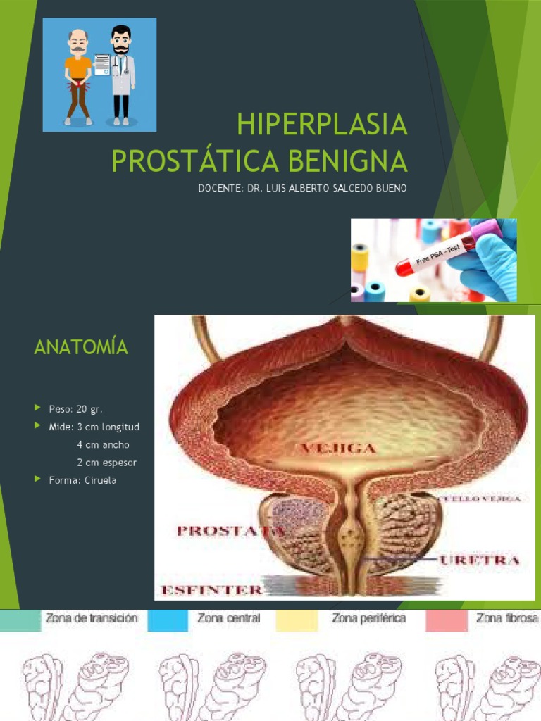 Hiperplasia Prostatica Benigna | PDF | Urología | Enfermedades del ...