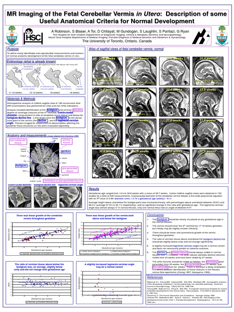 MR Imaging of The Fetal Cerebellar Vermis in Utero: Description of Some ...