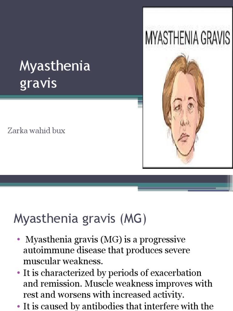 Understanding Myasthenia Gravis: Signs, Symptoms, Diagnosis and ...