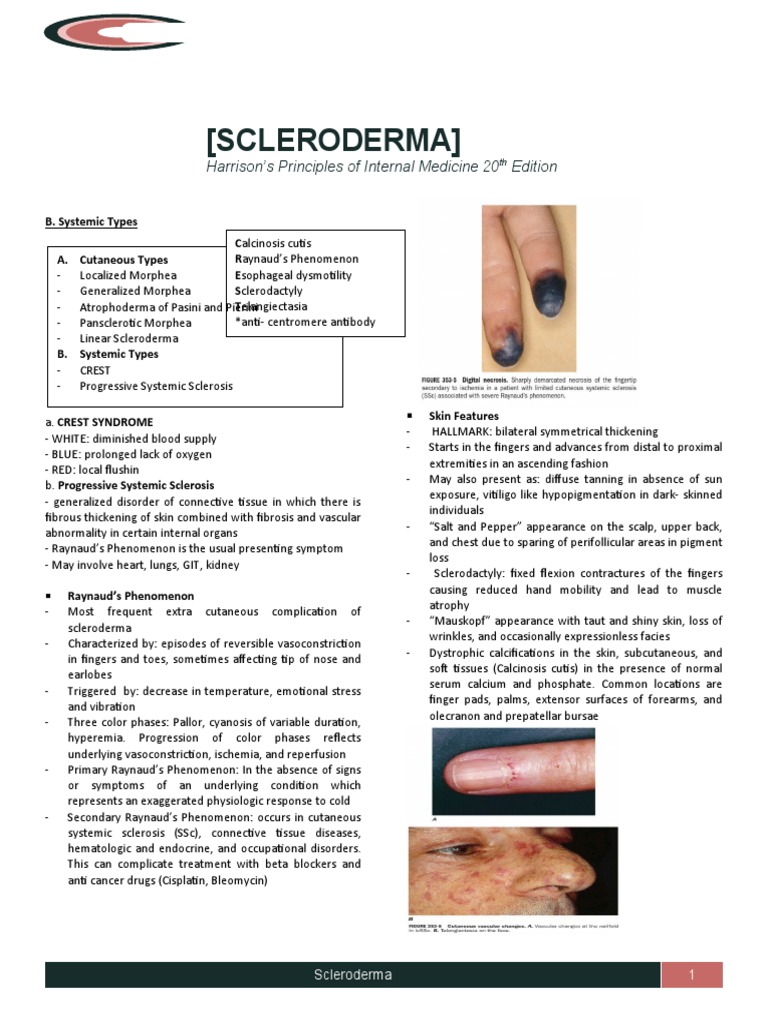 Scleroderma Overview and Management | PDF | Epidemiology | Diseases And ...
