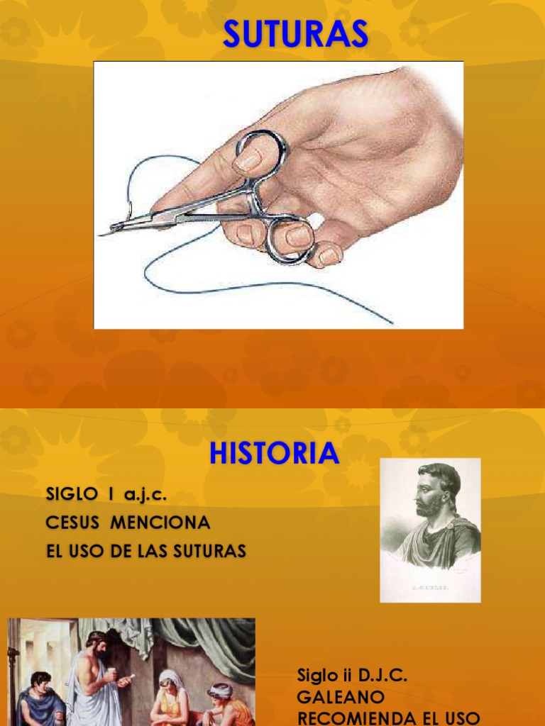 Suturas 151019030849 Lva1 App6892 | PDF | Sutura Quirúrgica | Seda