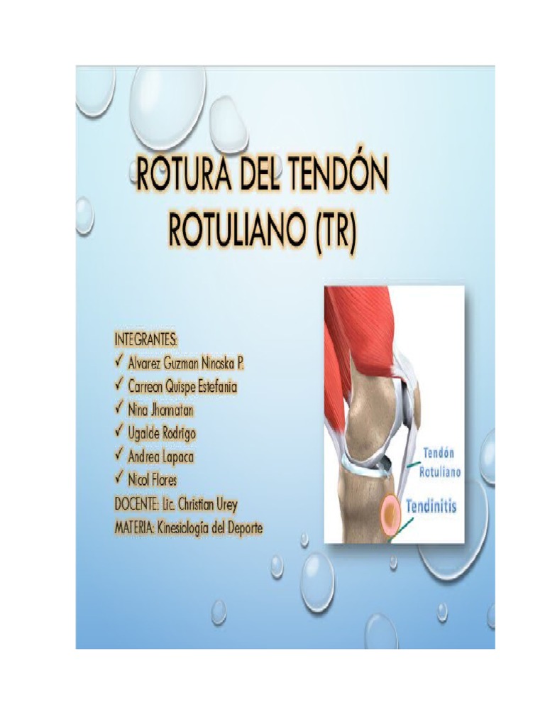 Rotura del Tendón Rotuliano: Diagnóstico y Tratamiento | PDF | Rodilla ...