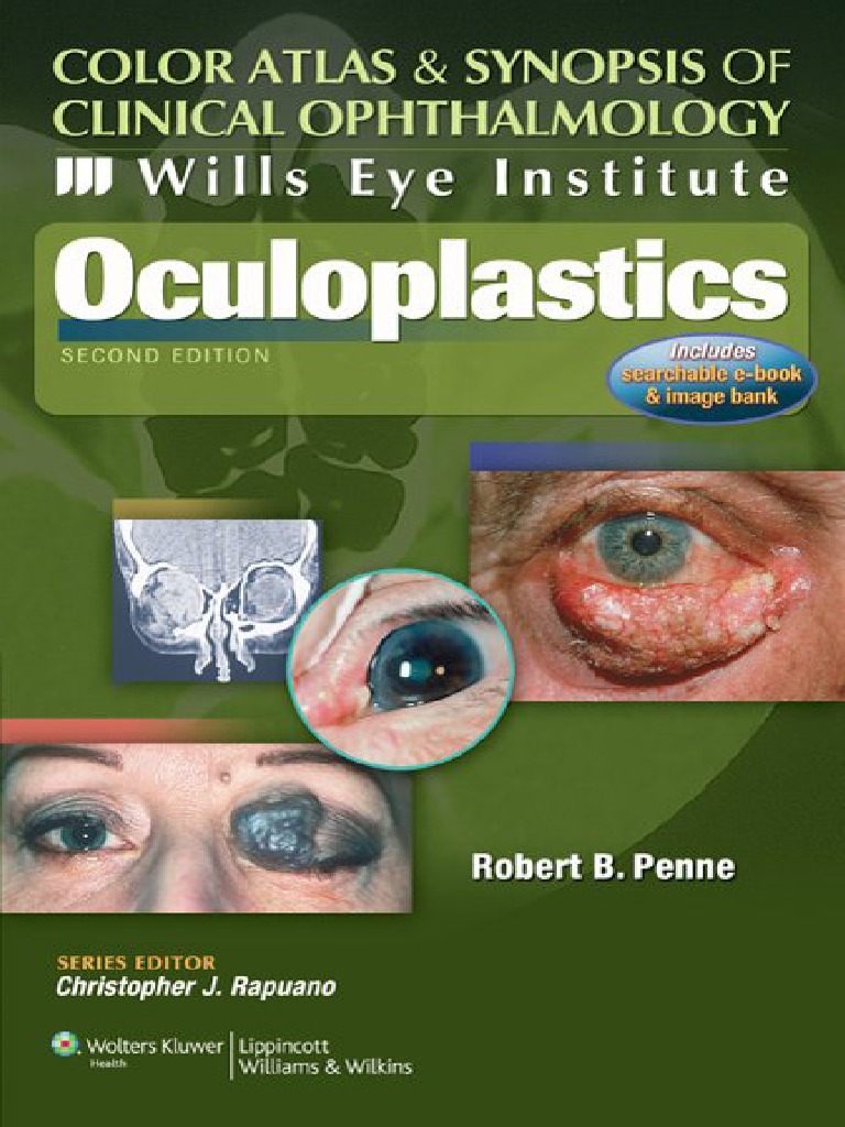 Color Atlas and Synopsis of Clinical Ophthalmology - Wills Eye ...
