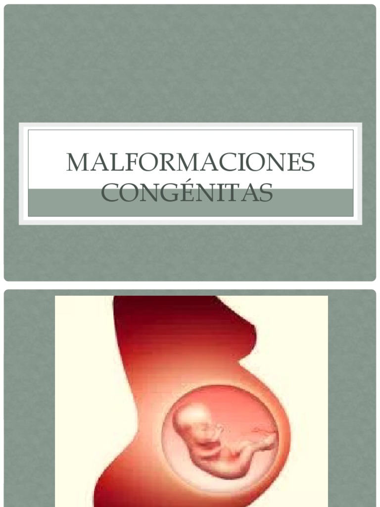 Malformaciones Congénitas: Guía Clínica | PDF | Corazón | Fluido ...