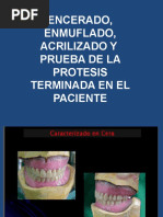 Festoneado en Odontología y Prótesis Total | PDF | Dentadura postiza ...