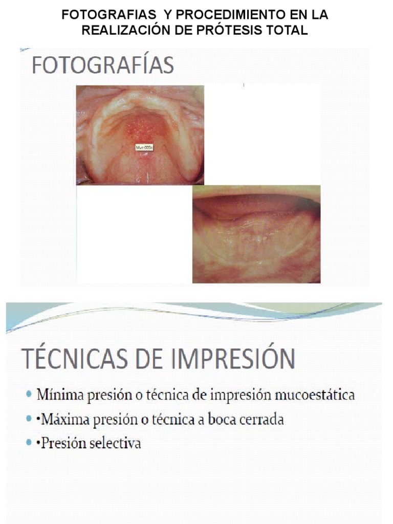 RODETES | PDF | Naturaleza