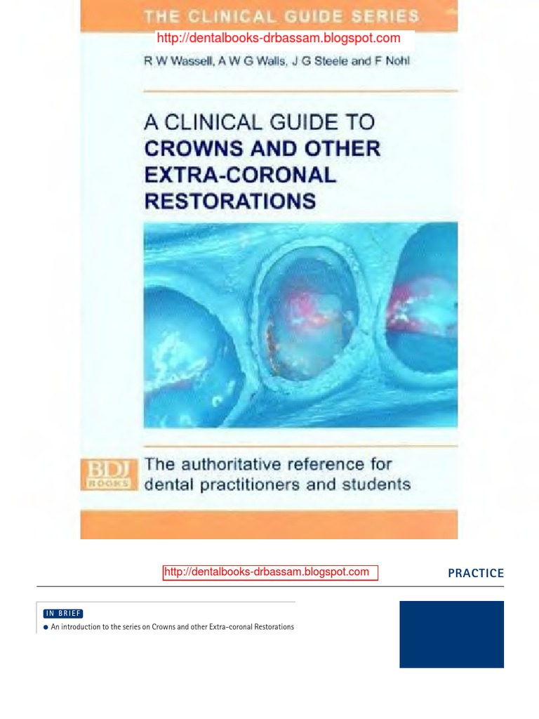 Crowns and Other Extra-Coronal Restoration | PDF | Dentistry | Mouth