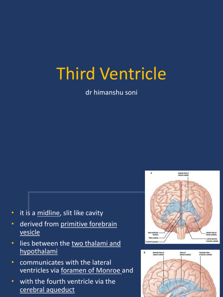 Third Ventricle Anatomy & Pathology | PDF | Central Nervous System ...