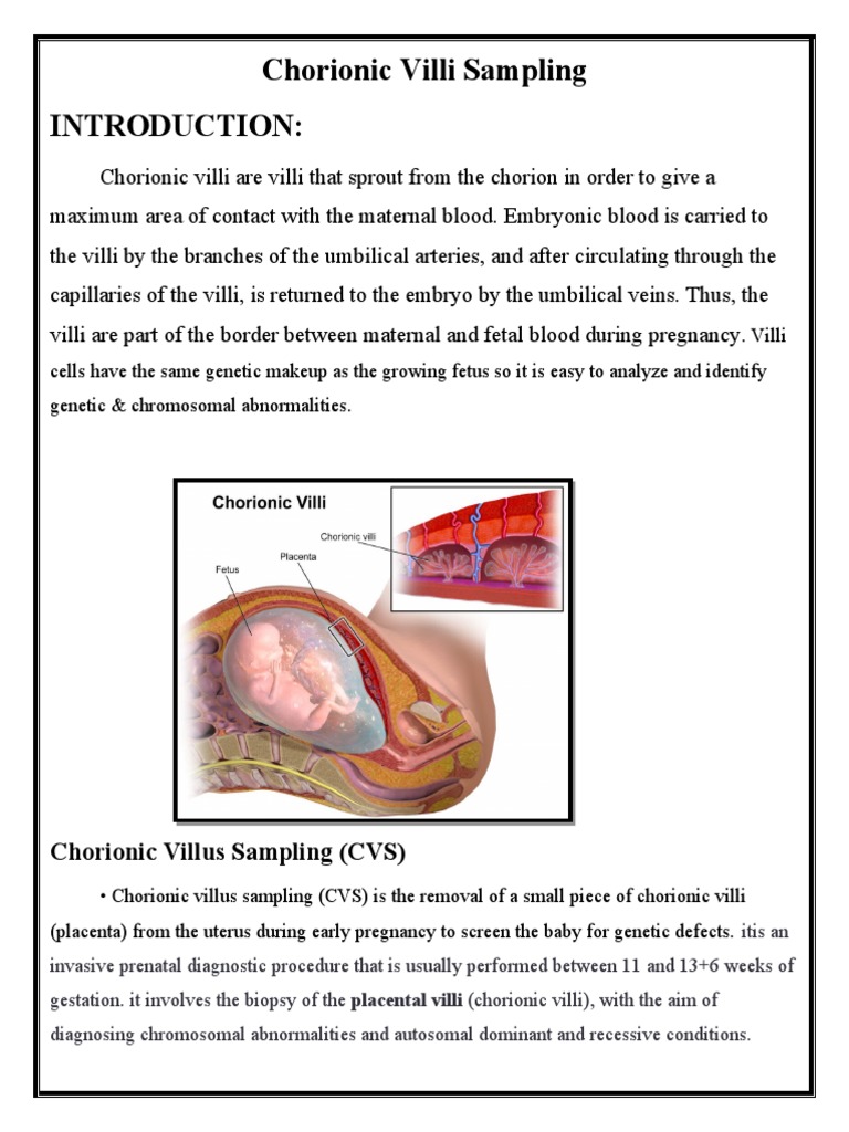 Chorionic Villi Sampling | PDF | Genetic Disorder | Fetus