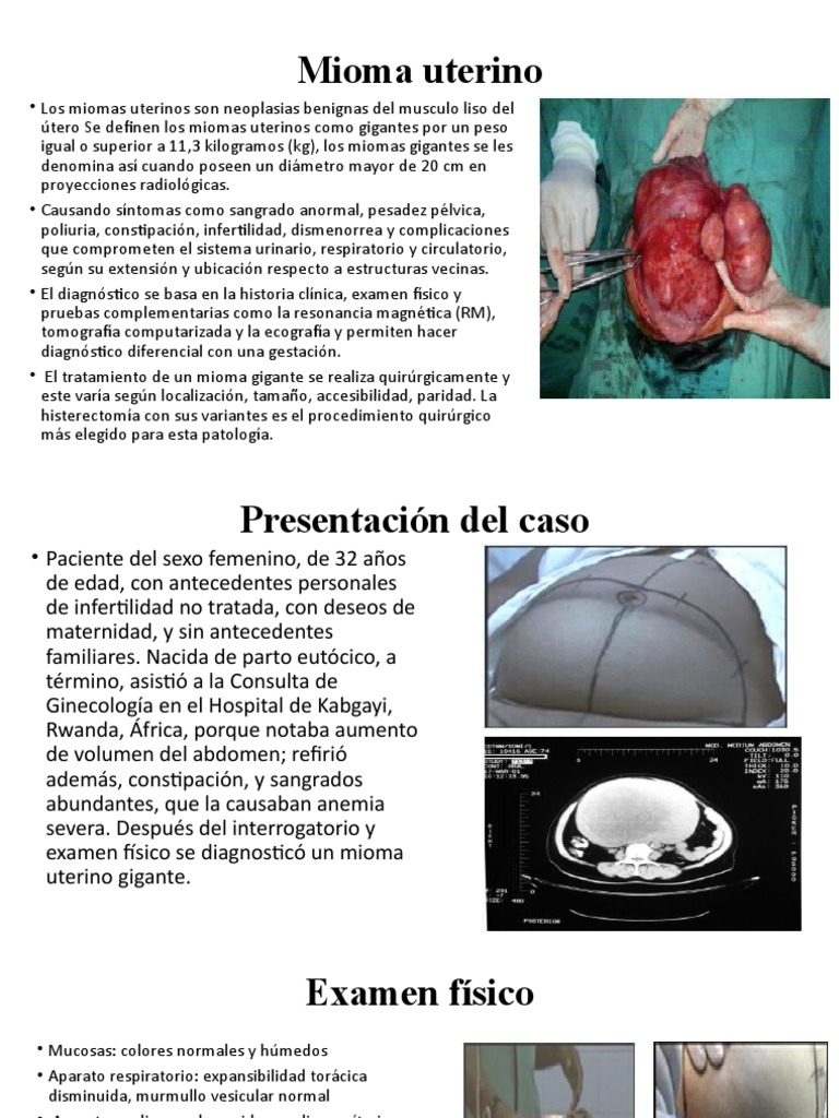 Mioma Uterino | PDF | Ultrasonido médico | El embarazo