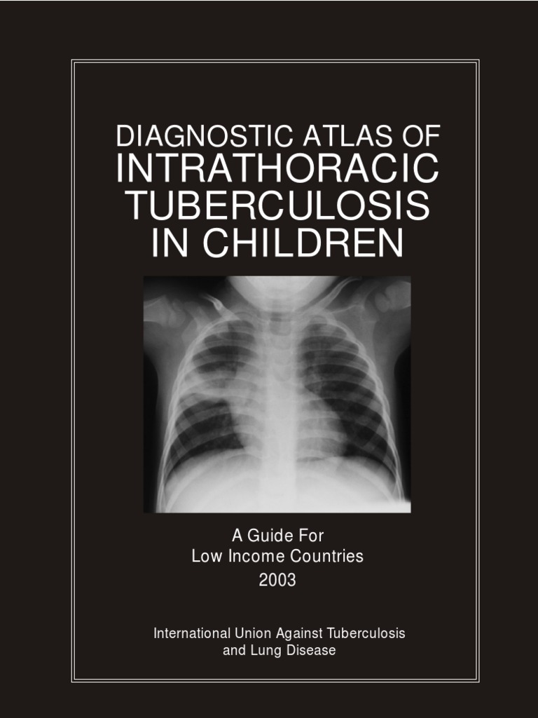 Tuberculosis Children Atlas | PDF | Tuberculosis | Pneumonia