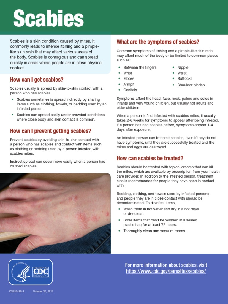 What Are The Symptoms of Scabies?: For More Information About Scabies ...