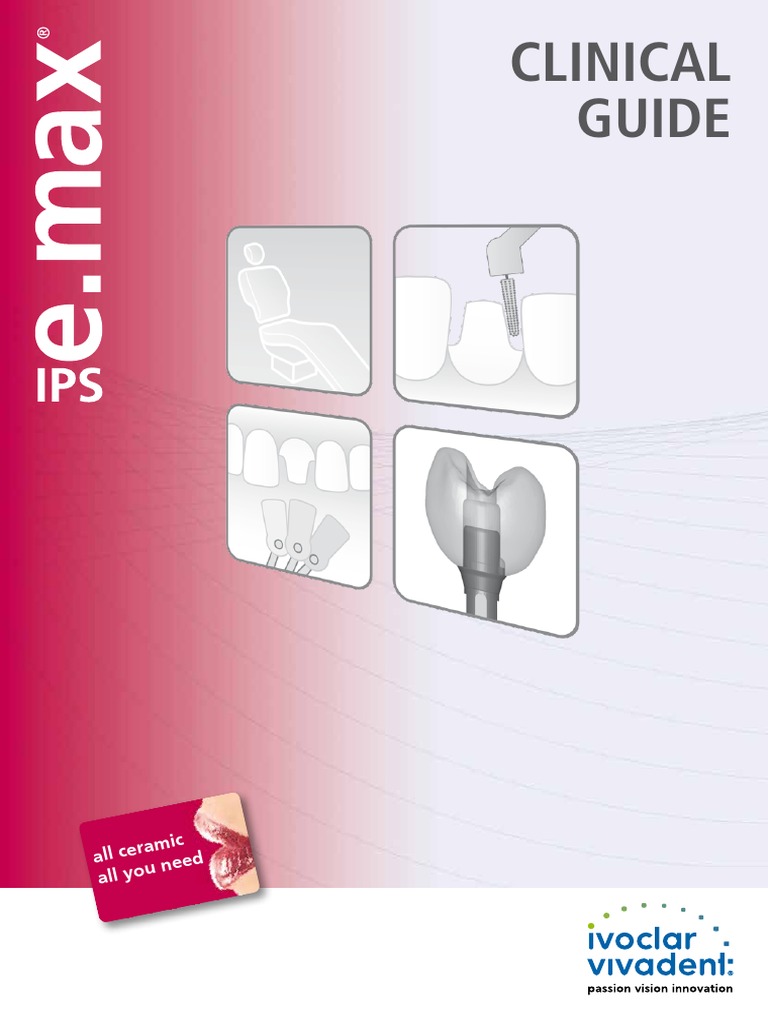 IPS E-Max Preparation Guide - Short | PDF | Dentistry | Mouth