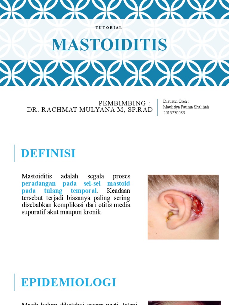 Mastoiditis | PDF