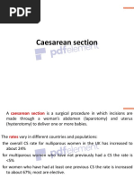 Case Study: Lower Segment Caesarean Section | PDF | Caesarean Section | Childbirth
