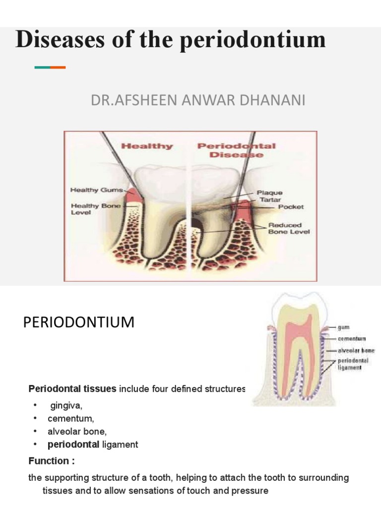 Review Pulpitis and Periapical Periodontits | PDF | Periodontology ...