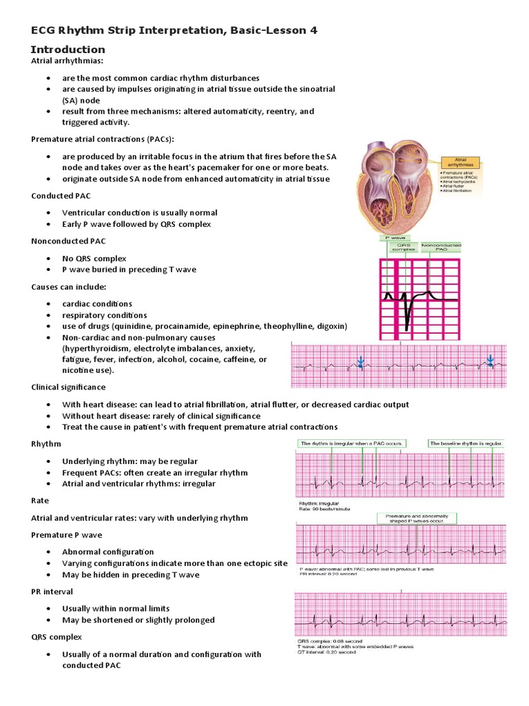 ECG Rhythm Strip Interpretation Lesson 4 | PDF | Heart ...