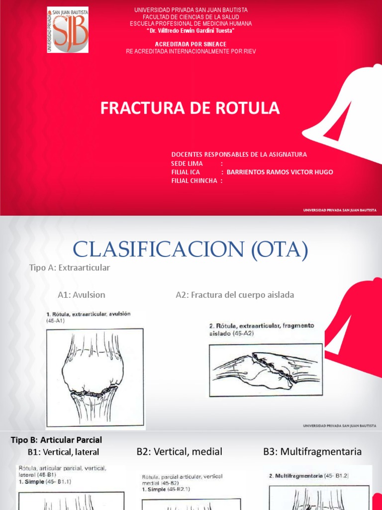 Clasificación de fracturas de rótula | PDF | Rodilla | Articulaciones