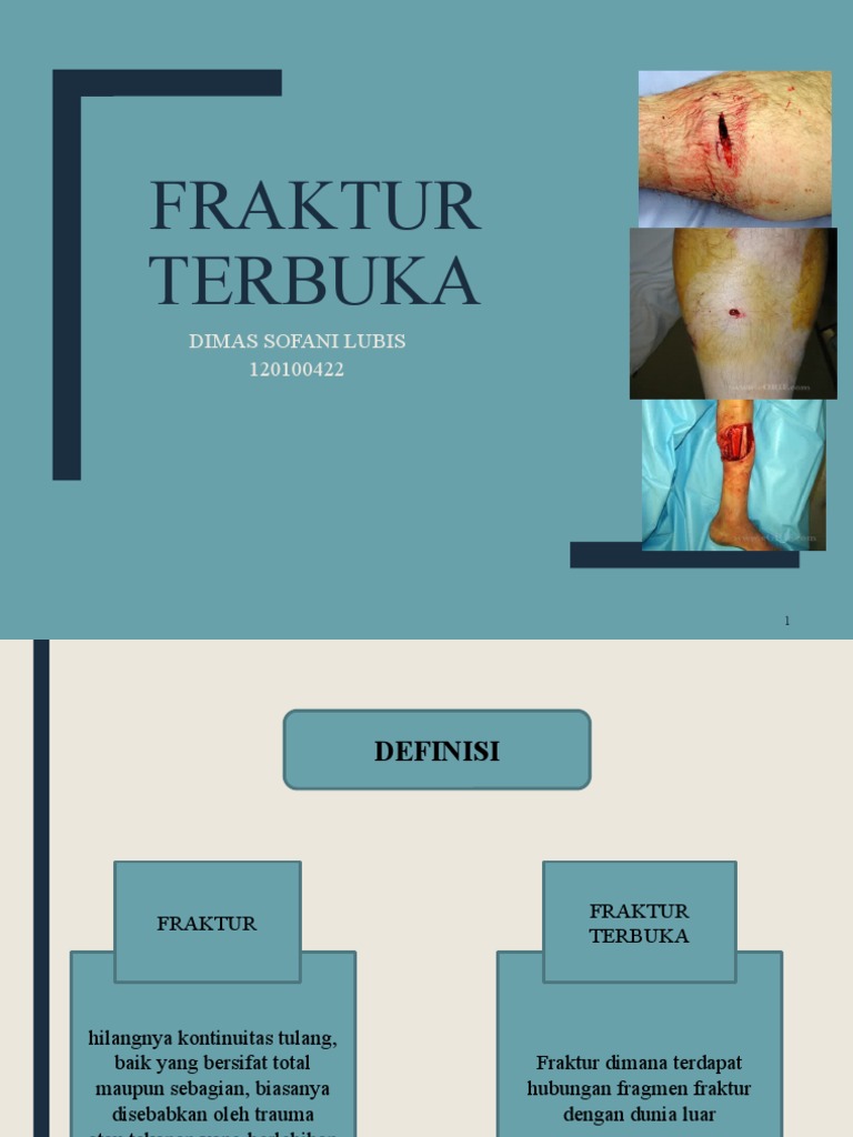 Fraktur Terbuka | PDF