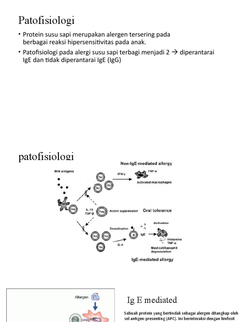 Alergi Susu Sapi | PDF