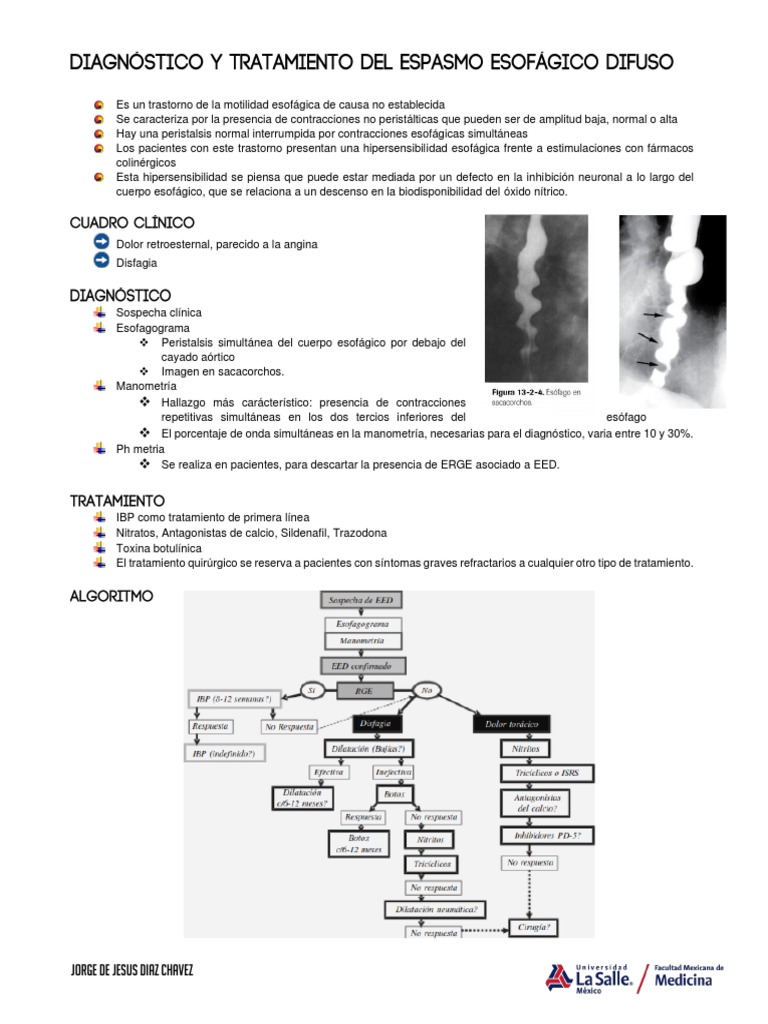 Diagnóstico y Tratamiento del Espasmo Esofágico | PDF | Salud y bienestar