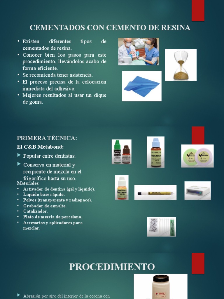 Cementados Con Cemento de Resina | PDF
