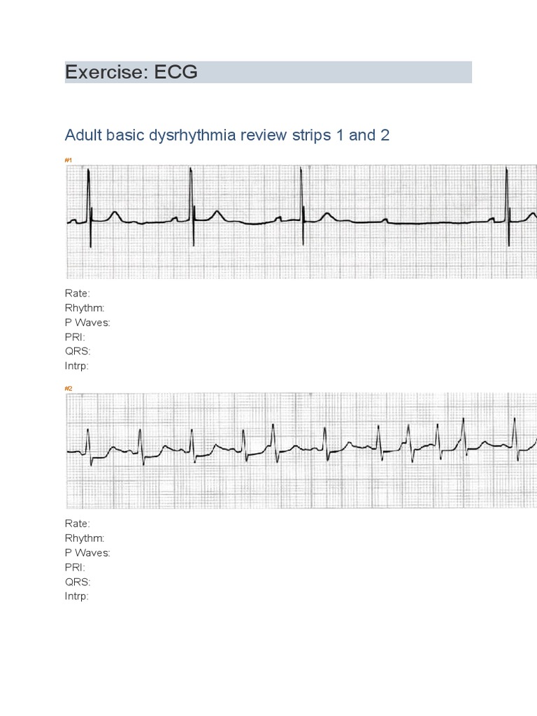 Exercise: ECG: Adult Basic Dysrhythmia Review Strips 1 and 2 | PDF