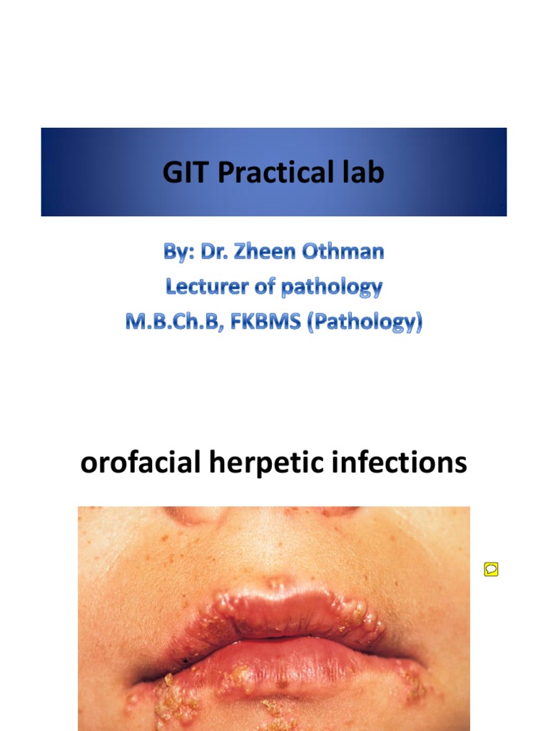 GIT Pathology (Practical) | PDF | Adenoma | Colorectal Cancer