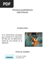 Pasos de la Cesárea Tipo Kerr | PDF | Abdomen | Seccion de cesárea