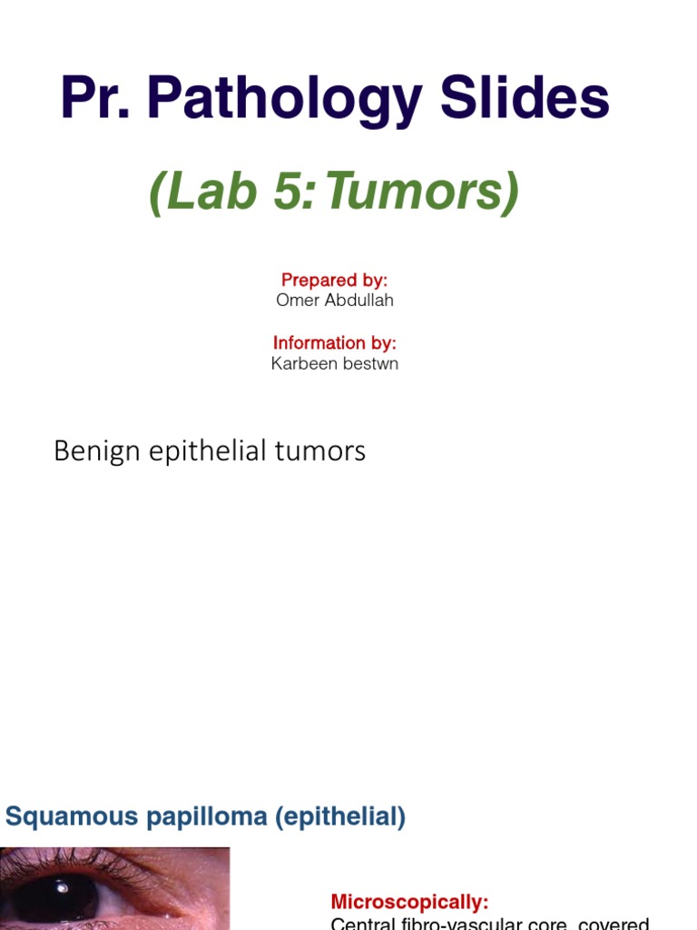 Pr. Pathology Slides: (Lab 5: Tumors) | PDF | Adenoma | Benign Tumor