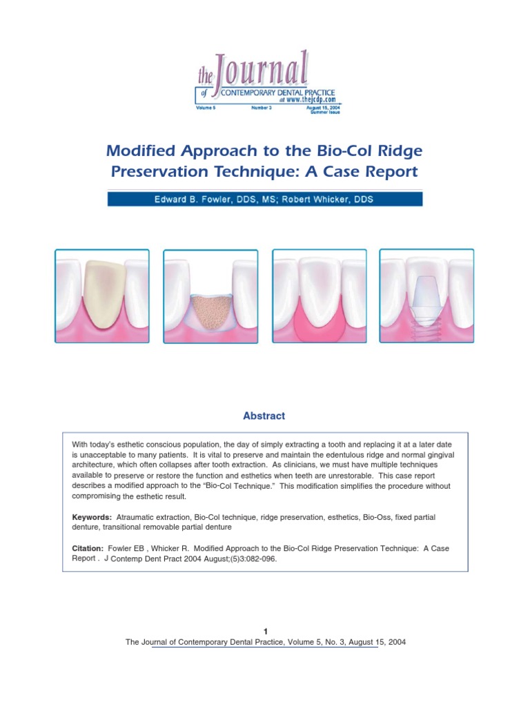 The Bio-Col Technique | PDF | Dental Implant | Human Tooth