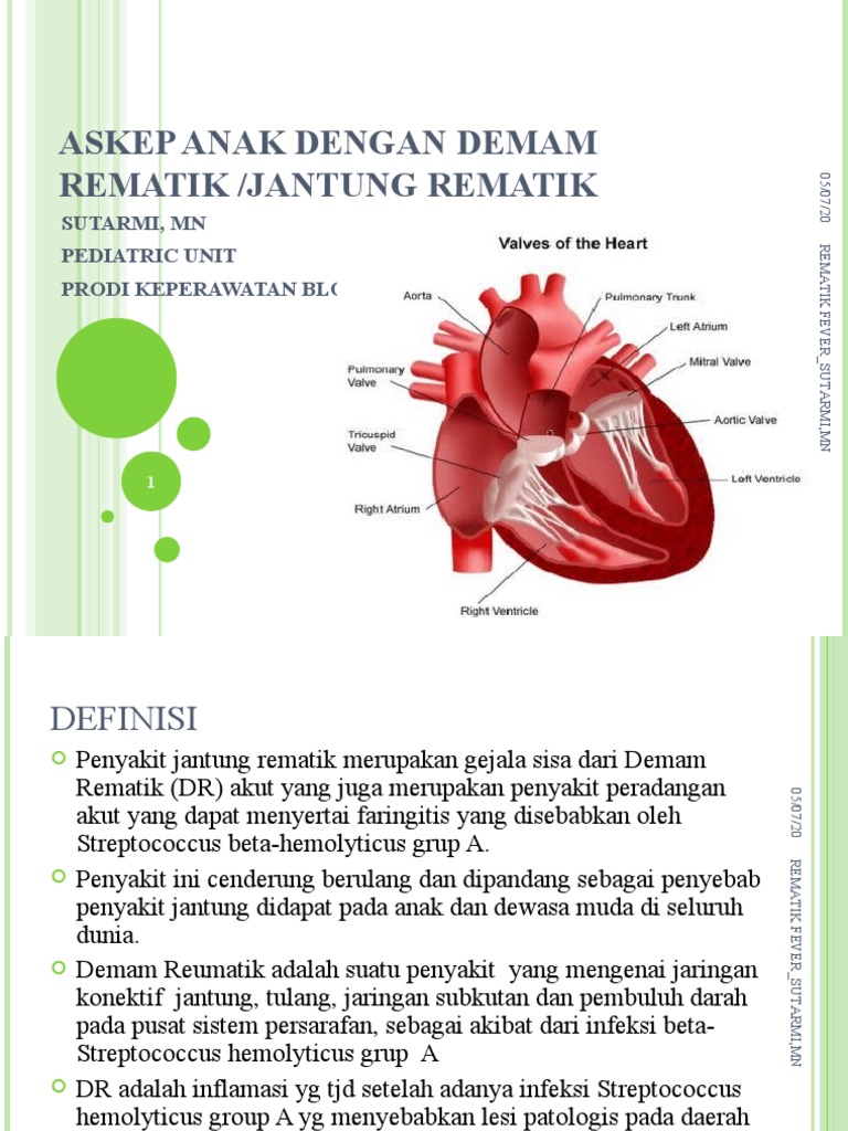 Askep Anak Dengan Demam Rematik Edited | PDF