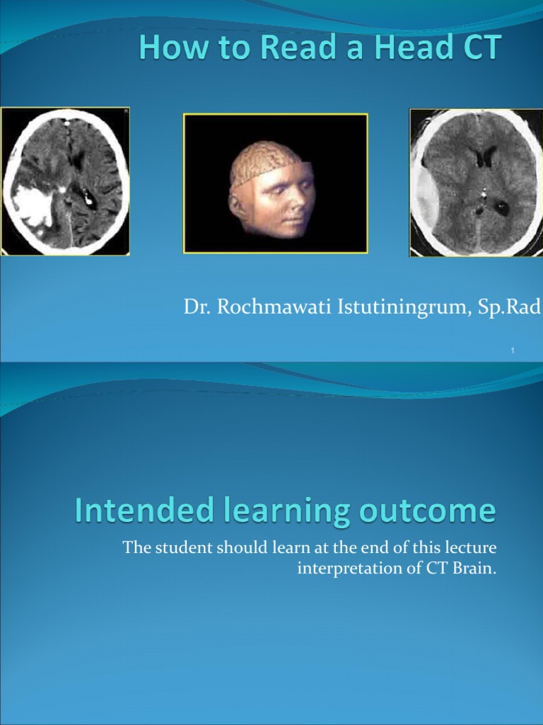 How To Read A Head CT Scan | PDF | Ct Scan | Clinical Medicine