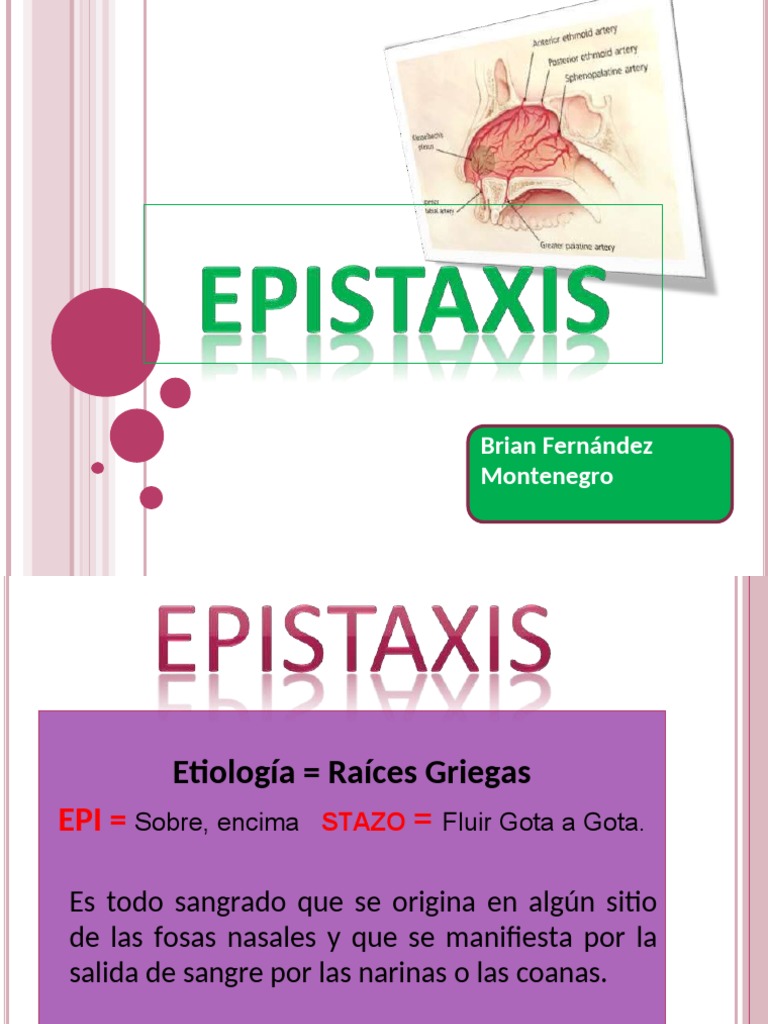 Epistaxis 160430174350 | PDF | Especialidades Medicas | Medicina CLINICA