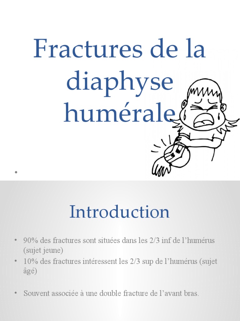 Fractures Diaphyse Humérale : Types et Traitements | PDF ...