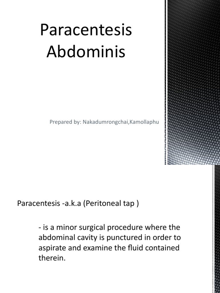 Diagnosing and Relieving Abdominal Fluid Buildup Through Paracentesis ...
