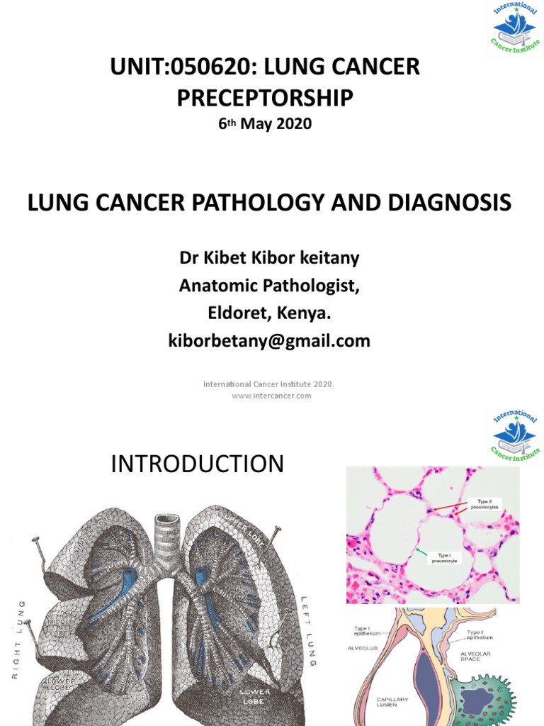 Lung Cancer Pathology and Diagnosis | PDF | Carcinoma | Lung Cancer