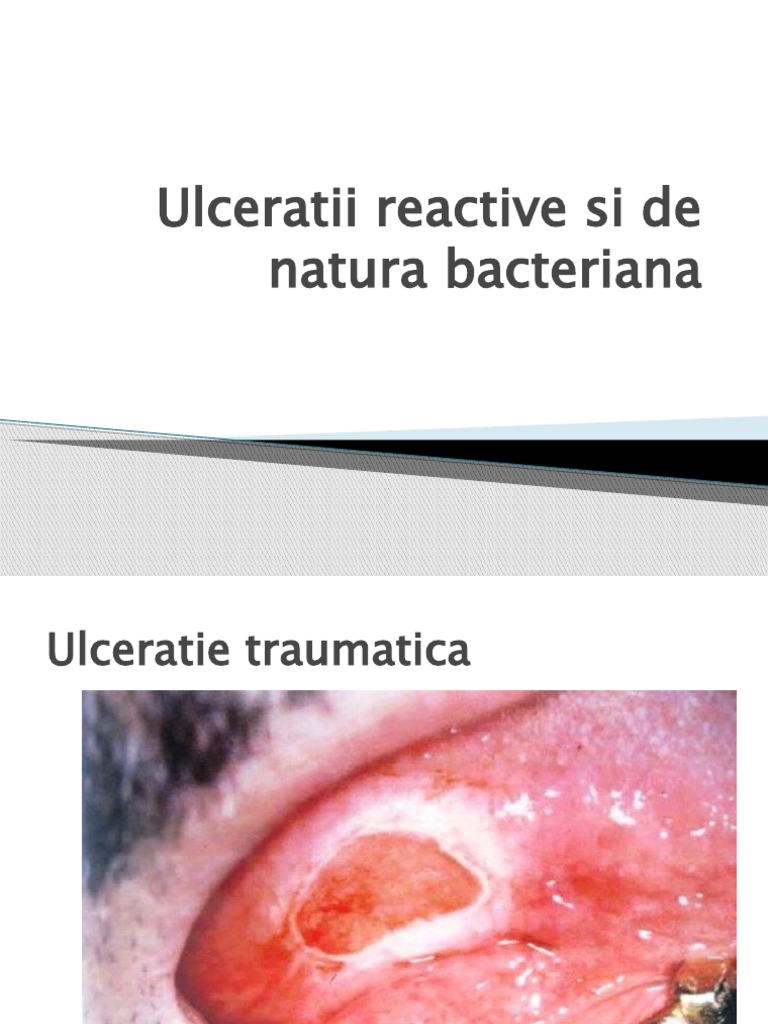 Ulceratii Reactive Si de Natura Bacteriana | PDF | Law