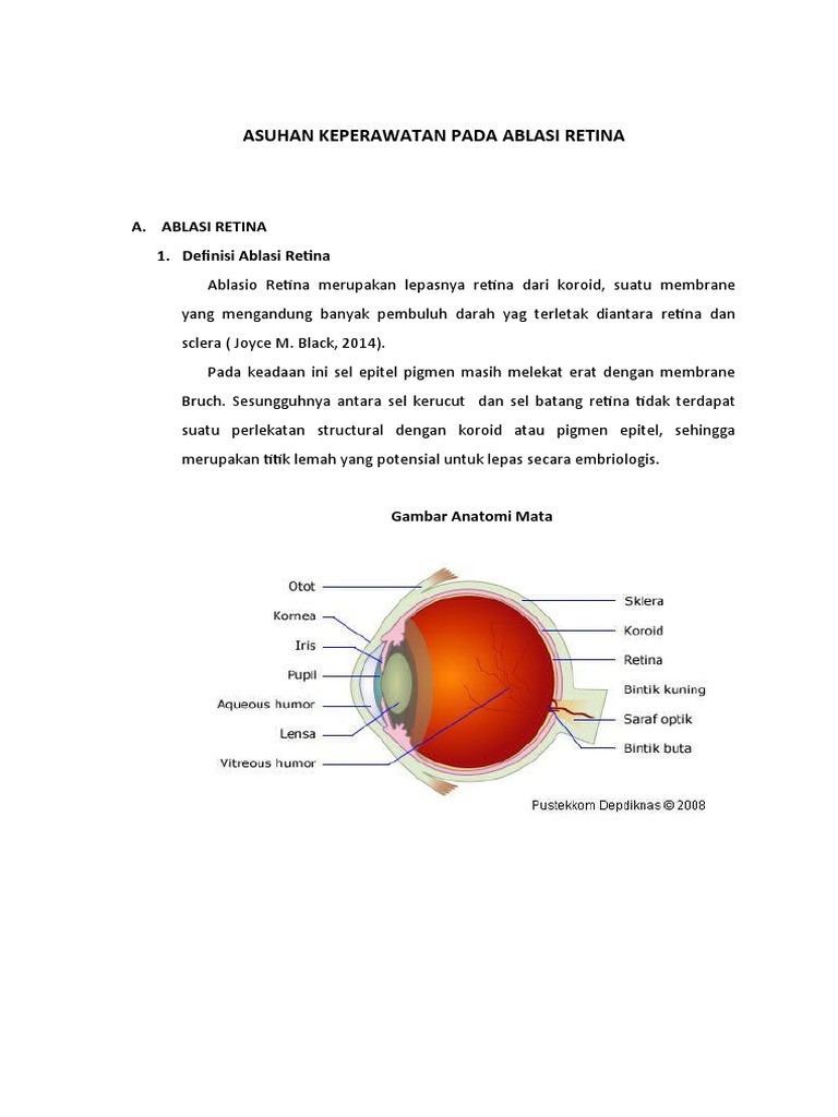 Ablatio Retina | PDF | Griya & Taman | Kesehatan Holistik