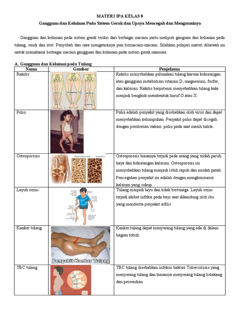 Materi Gangguan Sistem Gerak Manusia | PDF