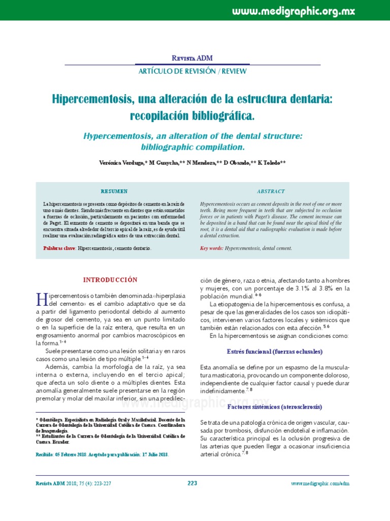 Hipercementosis, Una Alteración de La Estructura Dentaria: Recopilación ...