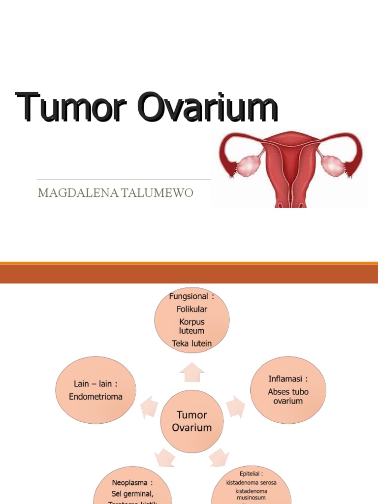 Tumor Ovarium | PDF